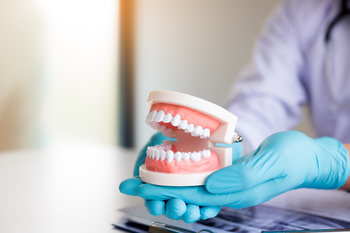 Exploring How Much Permanent Dentures Cost In Australia