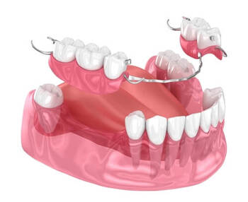 How To Whiten Dentures | Custom Denture Clinic