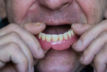 Fixed Dentures vs Removable Dentures: Choose the Right One